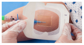 Buy 3M Tegaderm CHG IV Securement Dressings [FSA Approved]